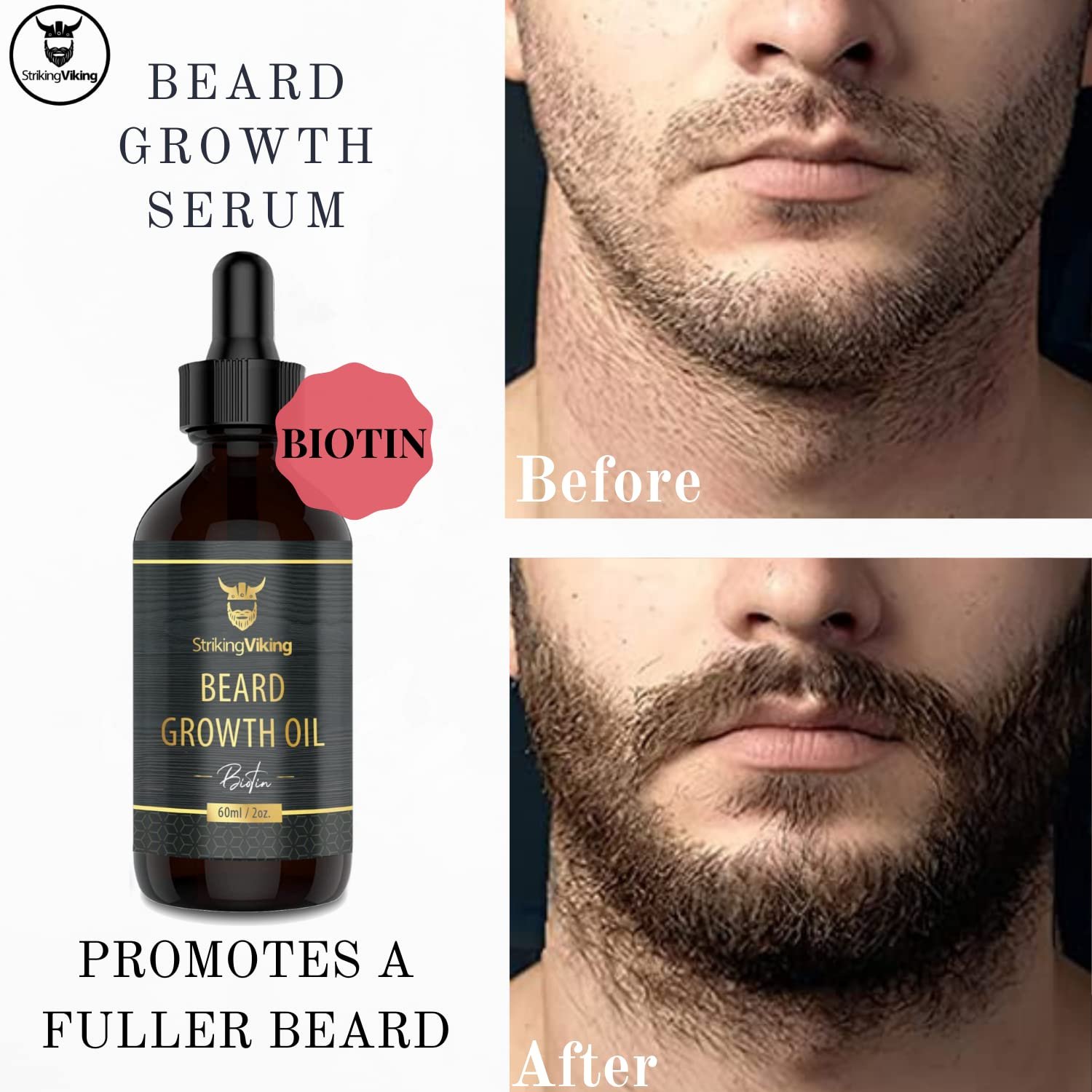 6 Beard Growth Oil Products for a Thicker Beard