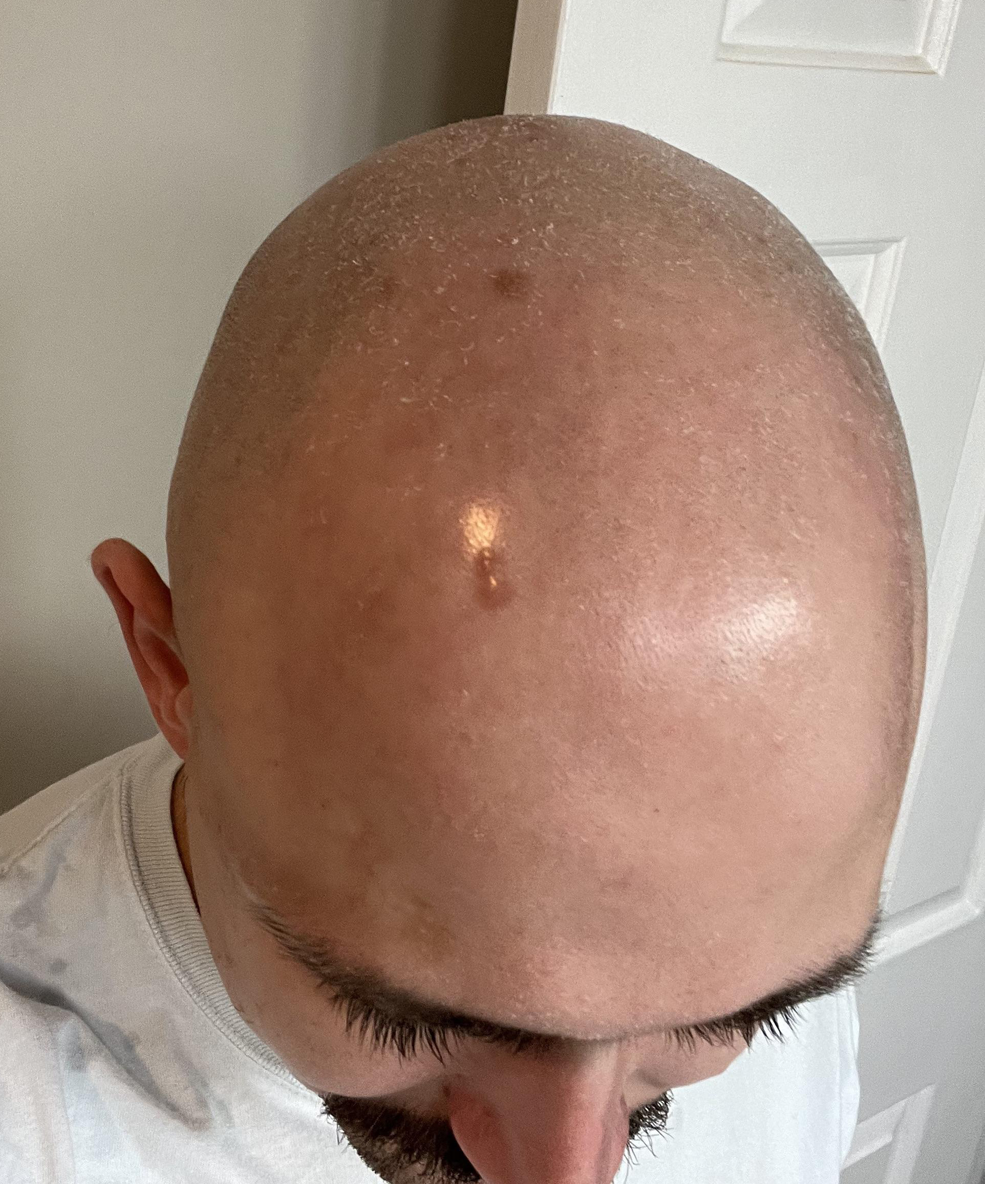 Bald Head Grooming Tips: Ultimate Guide and Product Recommendations